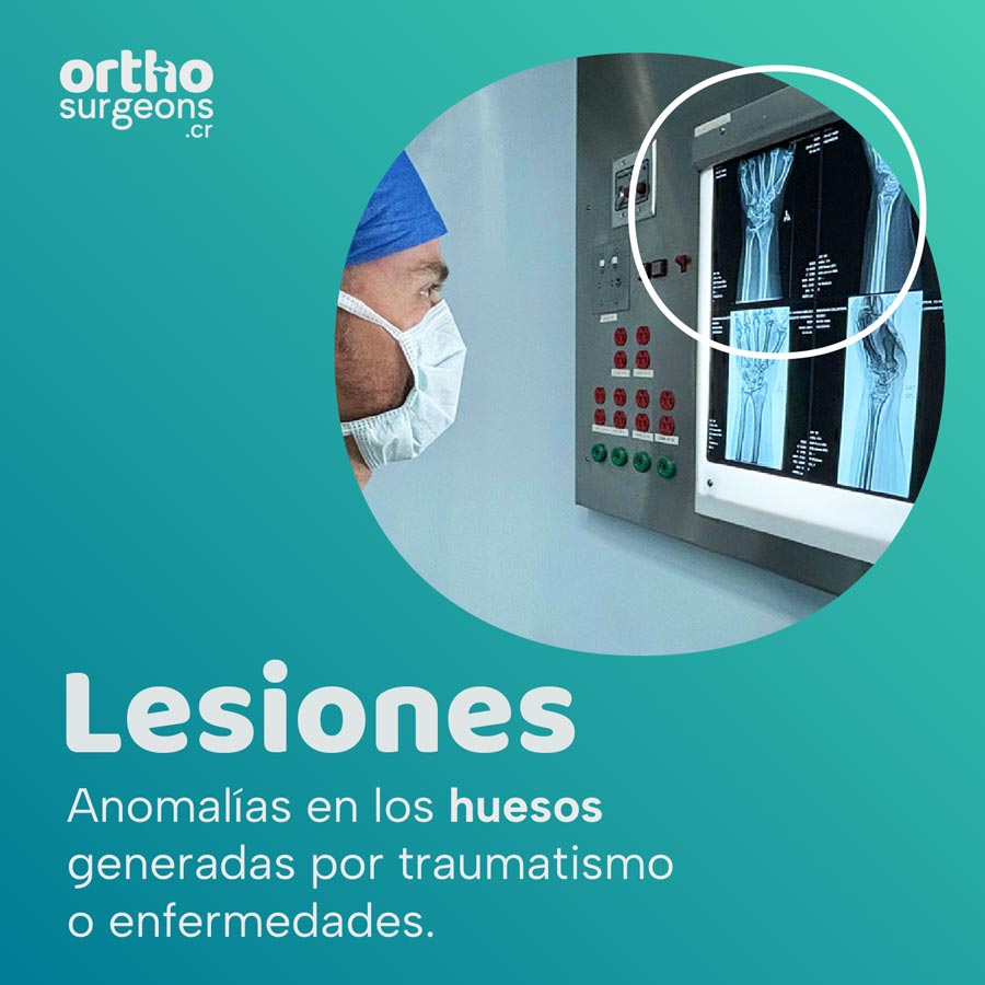 ¿Cuántos huesos tienen los humanos? | Orthosurgeons